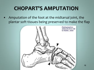 AMPUTATIONS-PRESENTATION.pptx