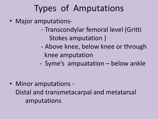 Amputations - A procedure no body wants or likes | PPTX