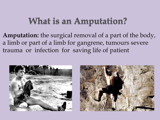 Amputations - A procedure no body wants or likes | PPT