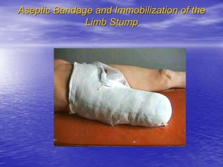 Amputations and disarticulations in limbs.ppt