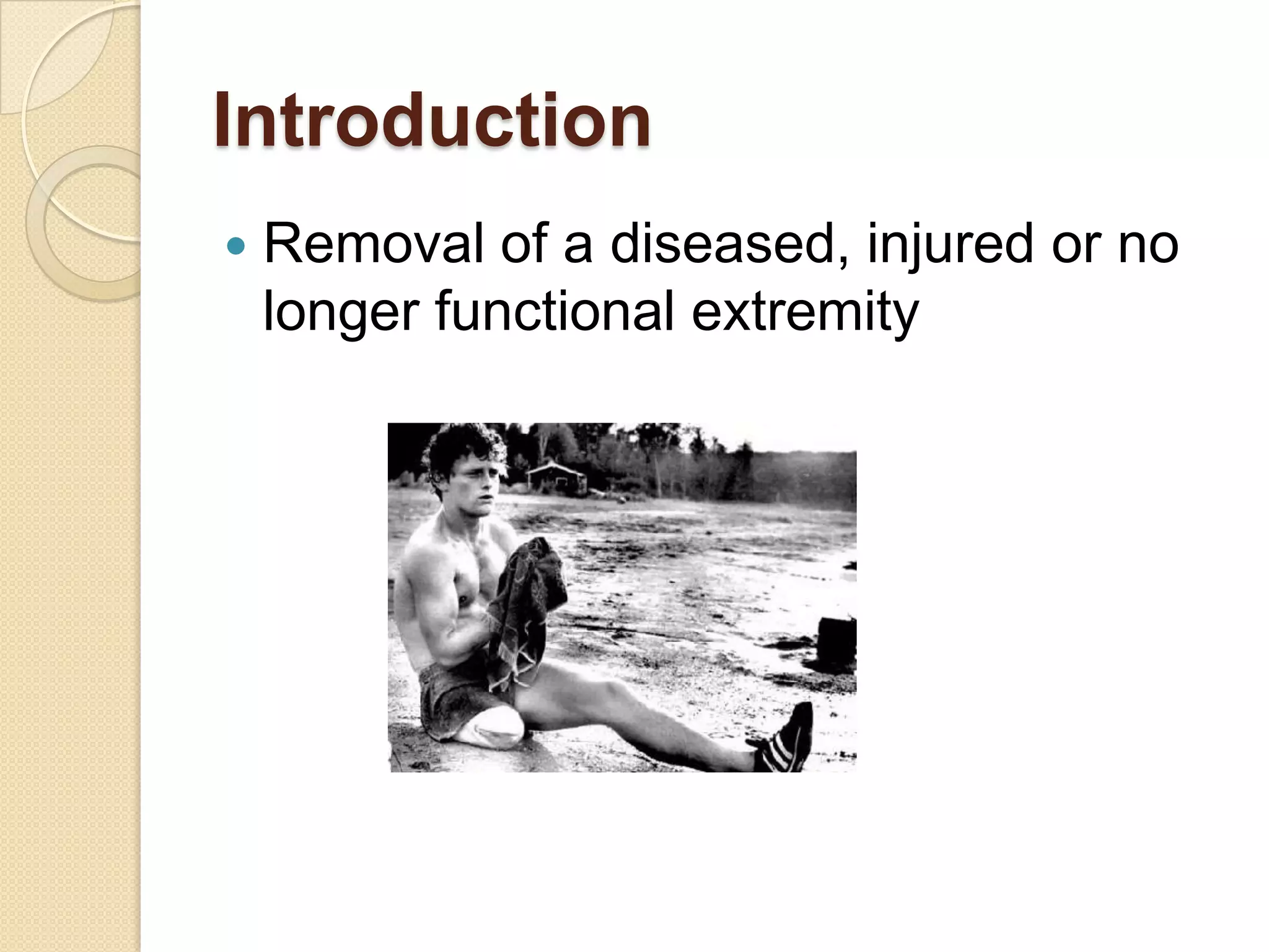 Amputations and hemipelvictomy | PPTX