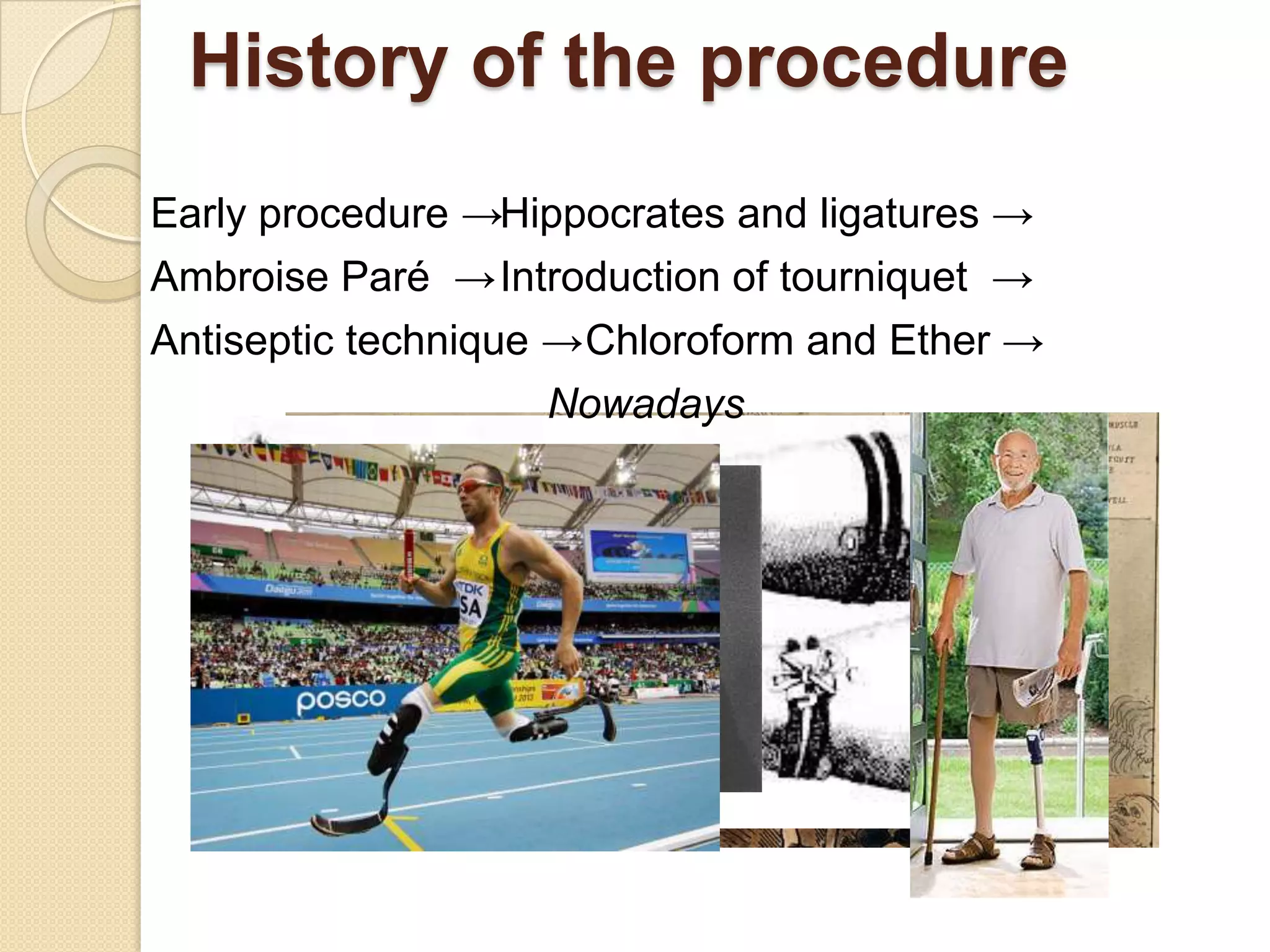 Amputations and hemipelvictomy | PPTX