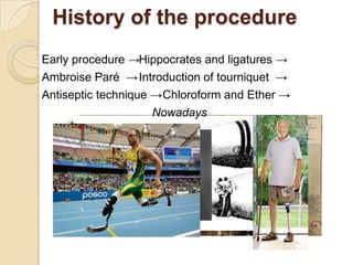 Amputations and hemipelvictomy | PPTX