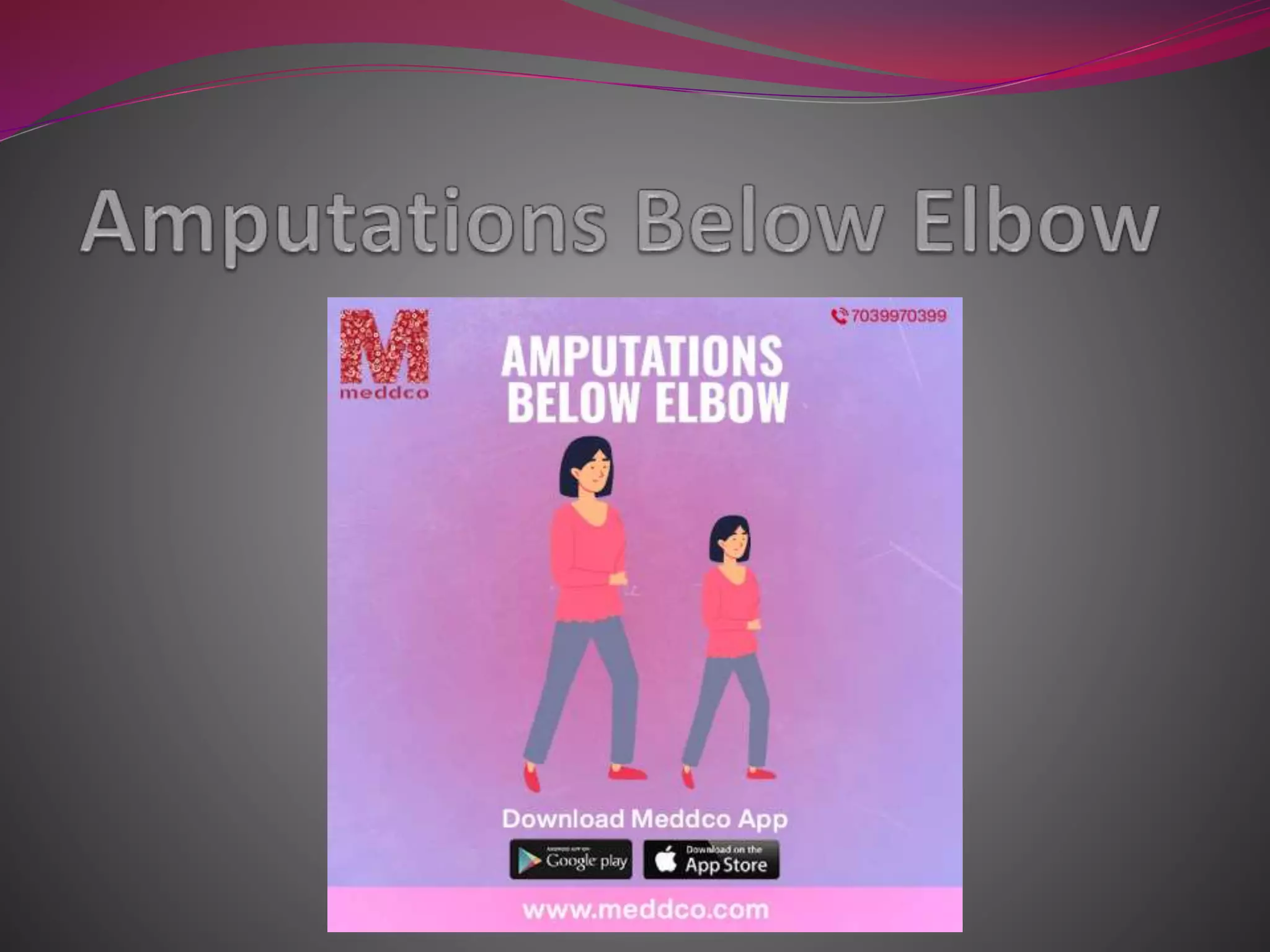 Amputations below elbow ppt | PPTX