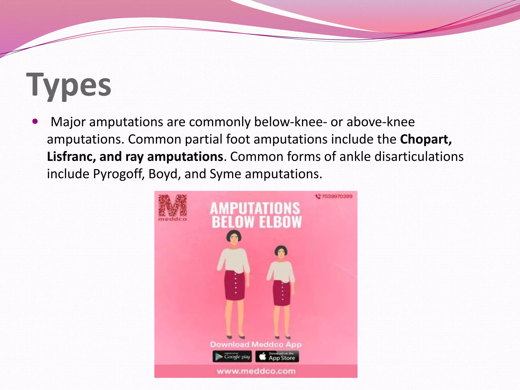 Amputations below elbow ppt | PPTX