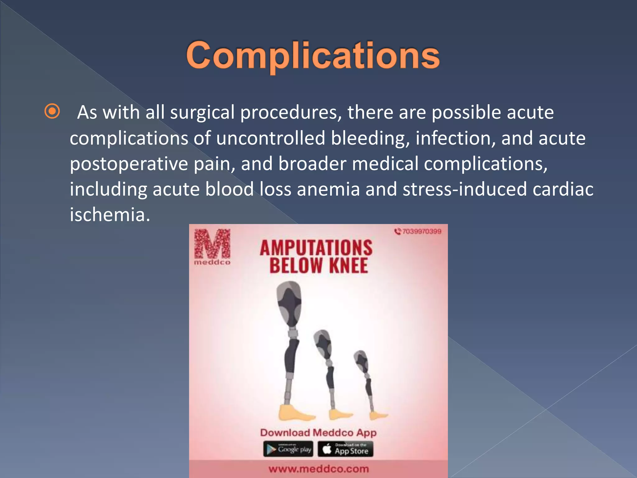 Amputations below knee | PPTX