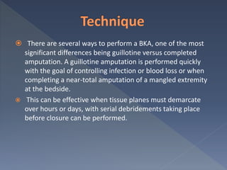 Amputations below knee | PPTX