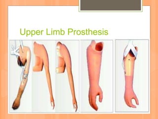 AMPUTATIONS IN LIMBS.pptx