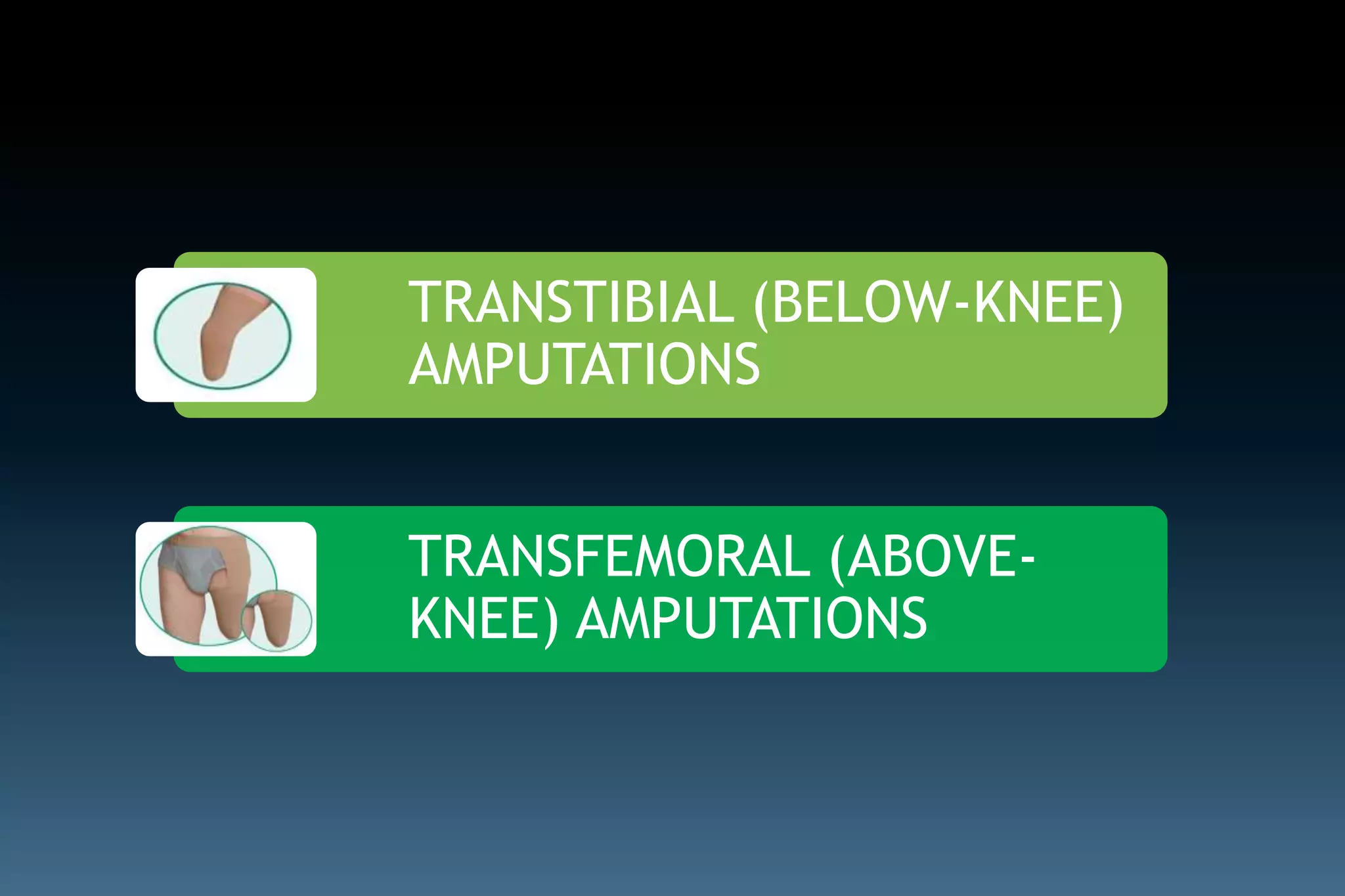 Amputations of the lower extremity | PPTX