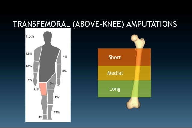 Amputations of the lower extremity