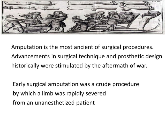 amputations pg.pptx