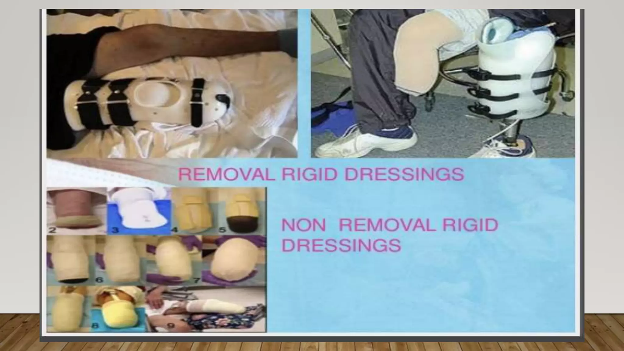 Amputation stump | PPTX