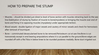 Amputation stump | PPTX