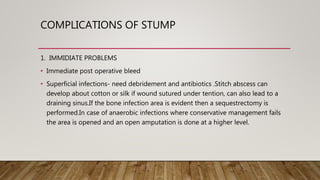 Amputation stump | PPT