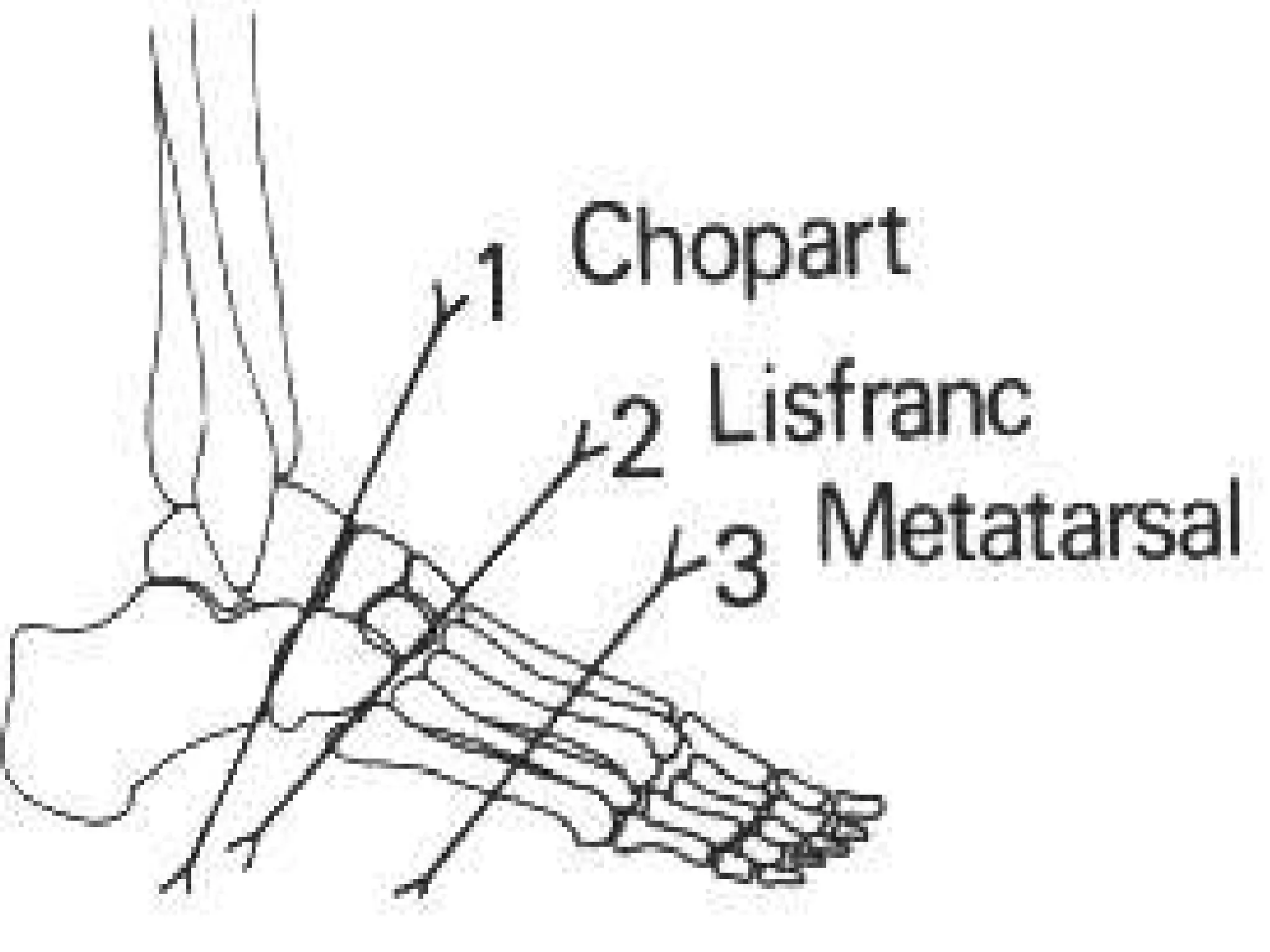 amputation stump care phantom limb.pptx