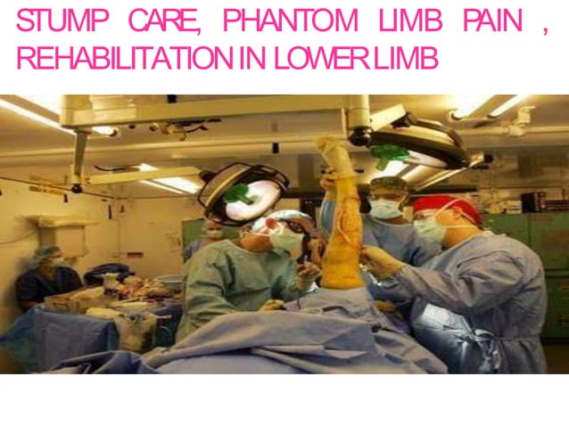 amputation stump care phantom limb.pptx | Death, Injury, or Military ...