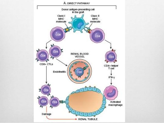 Antibody mediated rejection pathology histopathology