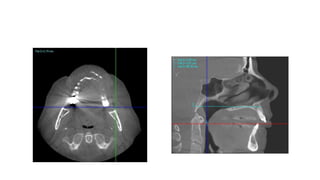 AMR case presentation format | PDF