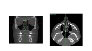 AMR case presentation format | PDF