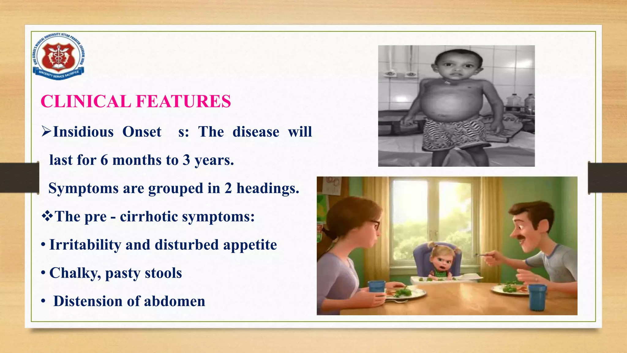 indian childhood cirrosis | PPTX