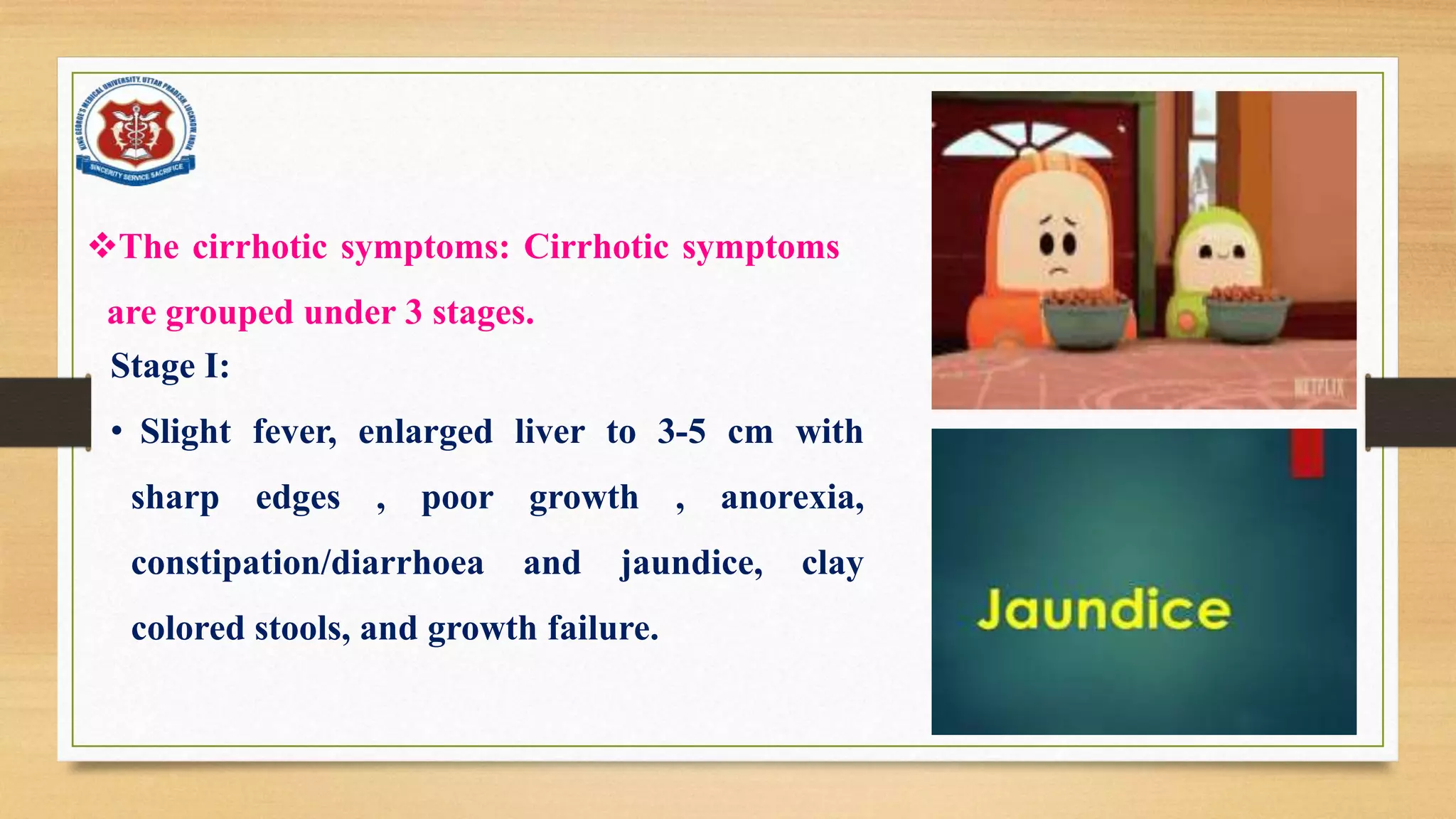 indian childhood cirrosis | PPTX
