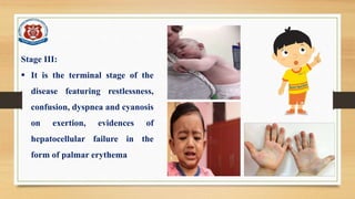 indian childhood cirrosis | PPTX