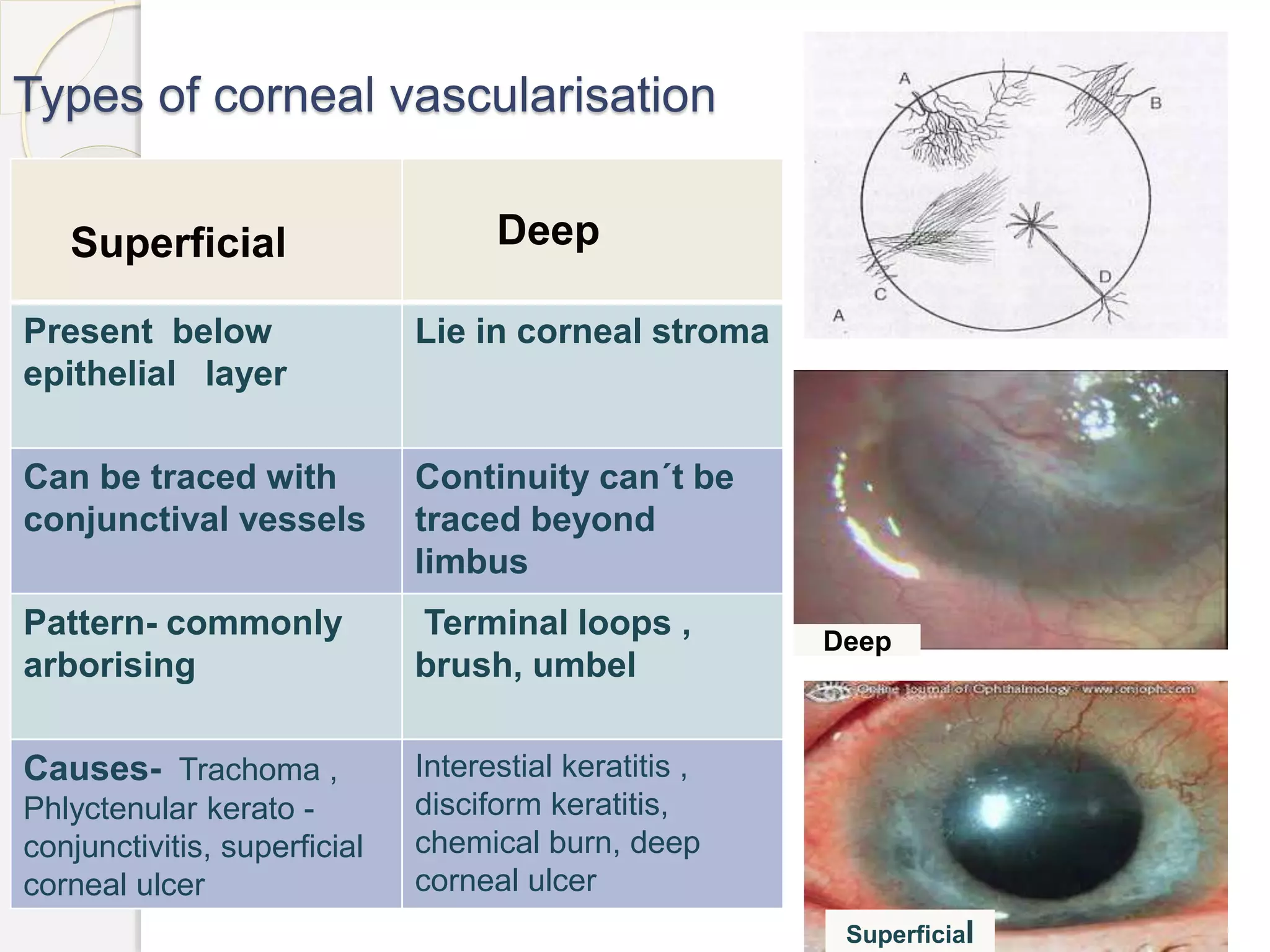 cornea physiology | PPTX