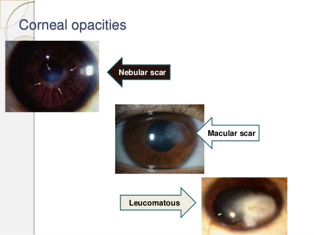 cornea physiology