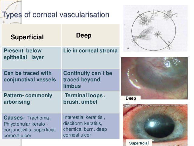 cornea physiology