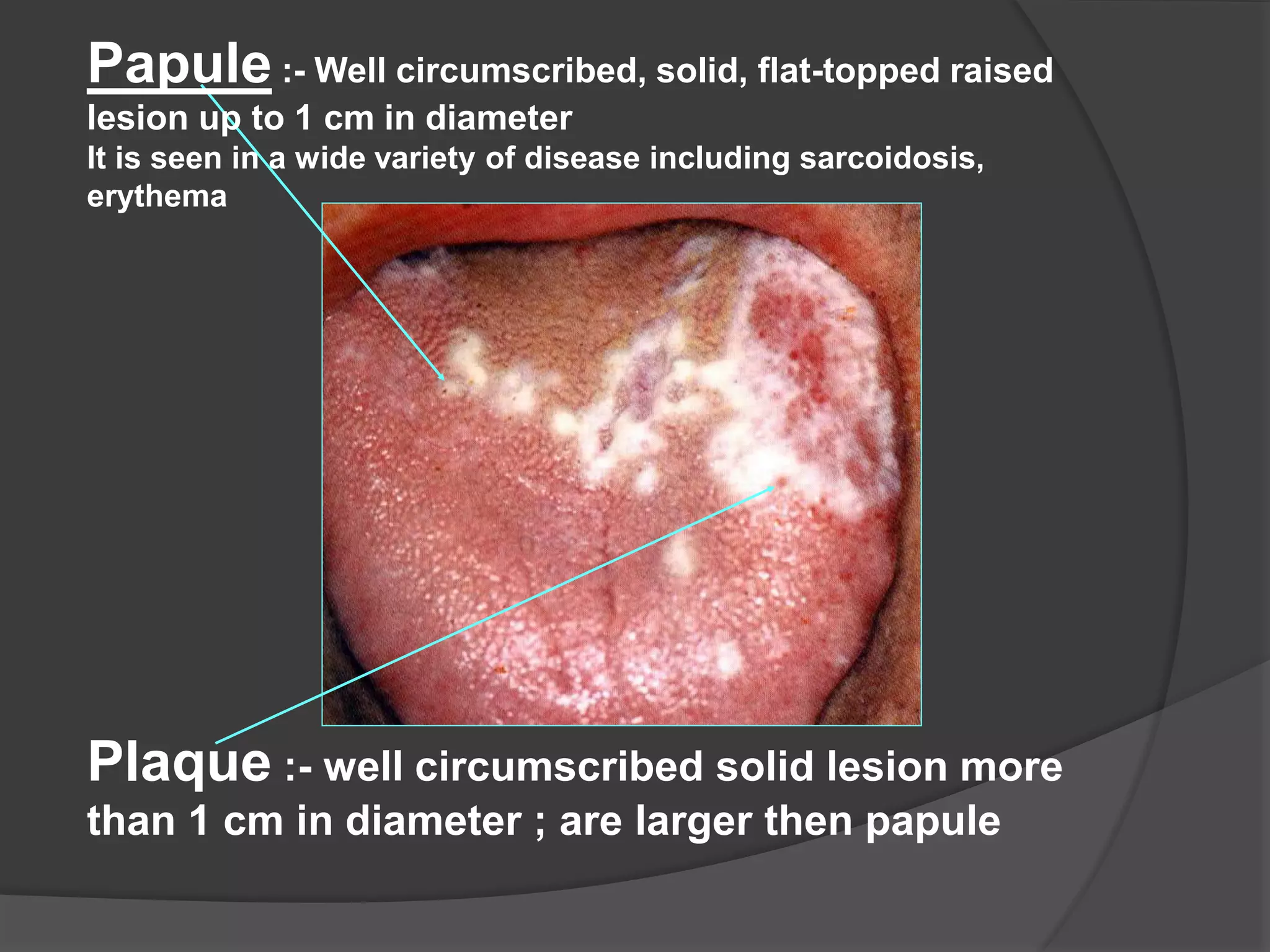 classification of lesion | PPTX