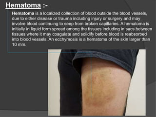 classification of lesion | PPTX