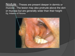 classification of lesion | PPTX