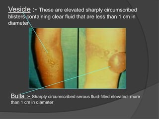 classification of lesion | PPTX