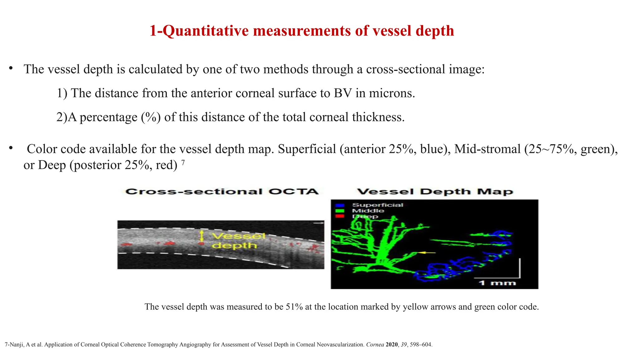 clinical application of OCT-A in anterior segment of the eye | PPTX