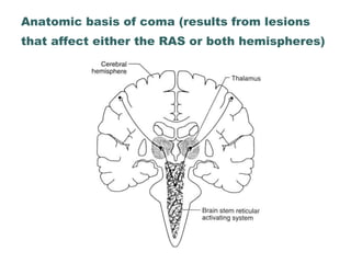 Altered Mental Status and Coma | PPTX | Brain and Nervous System ...