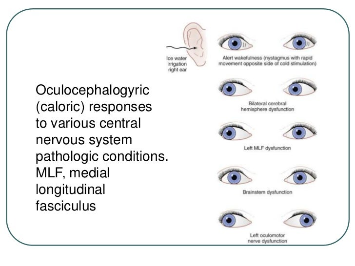 Altered Mental Status and Coma