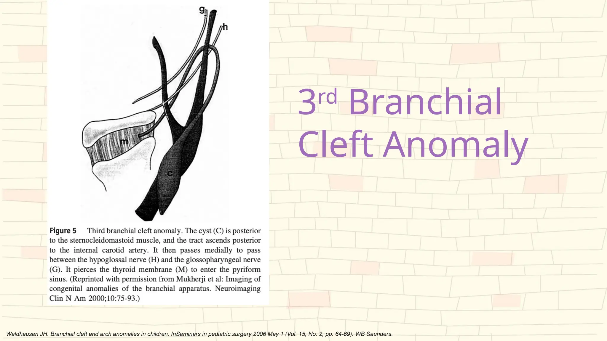 Branchial Cleft Anomalies and Pathology.pptx