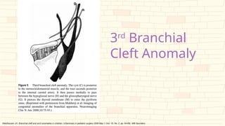 Branchial Cleft Anomalies and Pathology.pptx