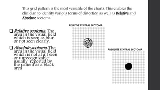 Amsler grid chart | PPTX