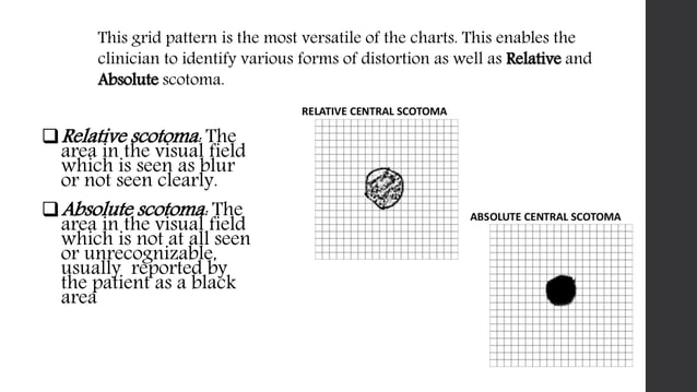 Amsler grid chart | PPT