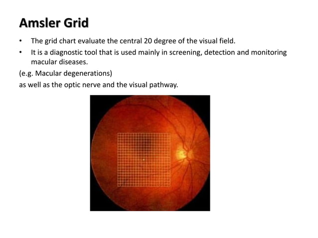 Amsler chart | PPTX