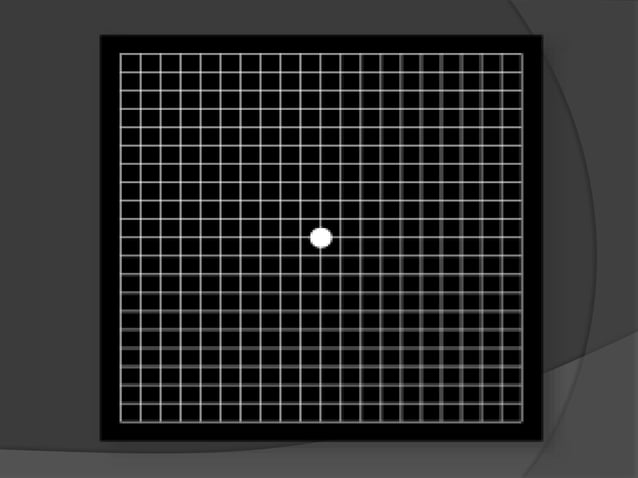 AMSLER CHARTS.pptx | Eye and Vision Conditions | Diseases and Conditions