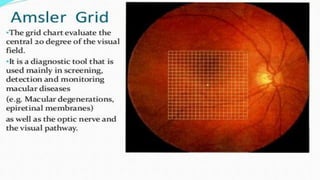 Amsler grid | PPT