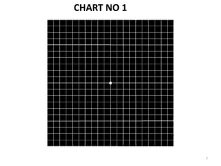 Amsler grid chart | PPTX