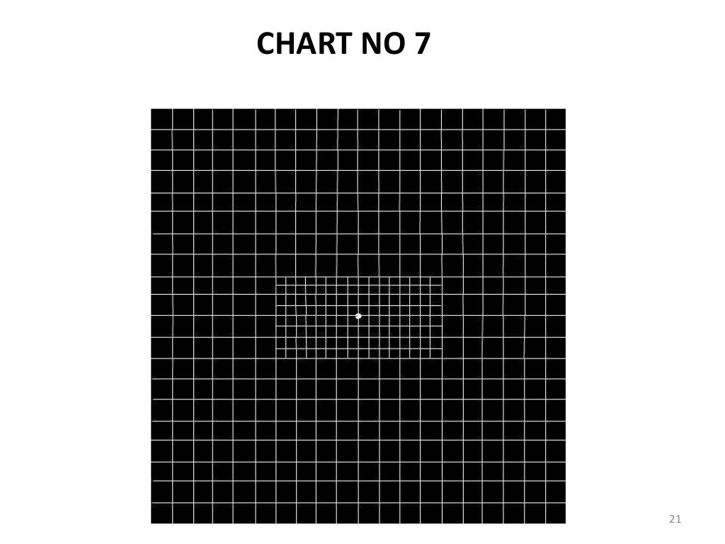 Amsler grid chart types - hssaad
