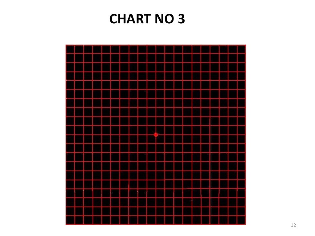 Amsler Grid Chart Amsler Grid Chart