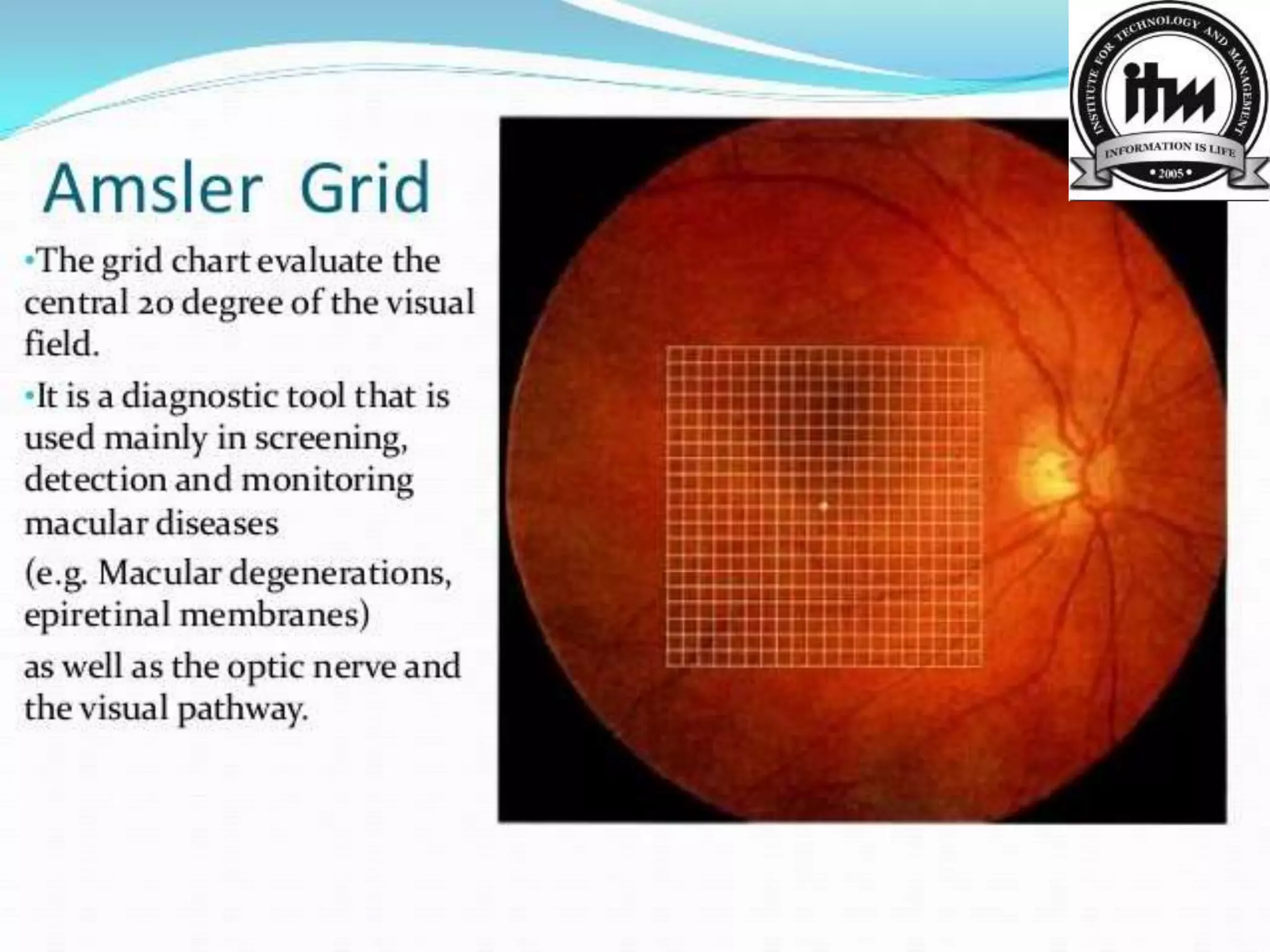Amsler grid chart | PPT