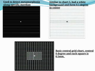 AMSLER GRID amsler Grid amsler grid.pptx