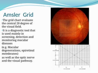 AMSLER GRID amsler Grid amsler grid.pptx