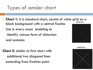 Amsler grid examination | PDF